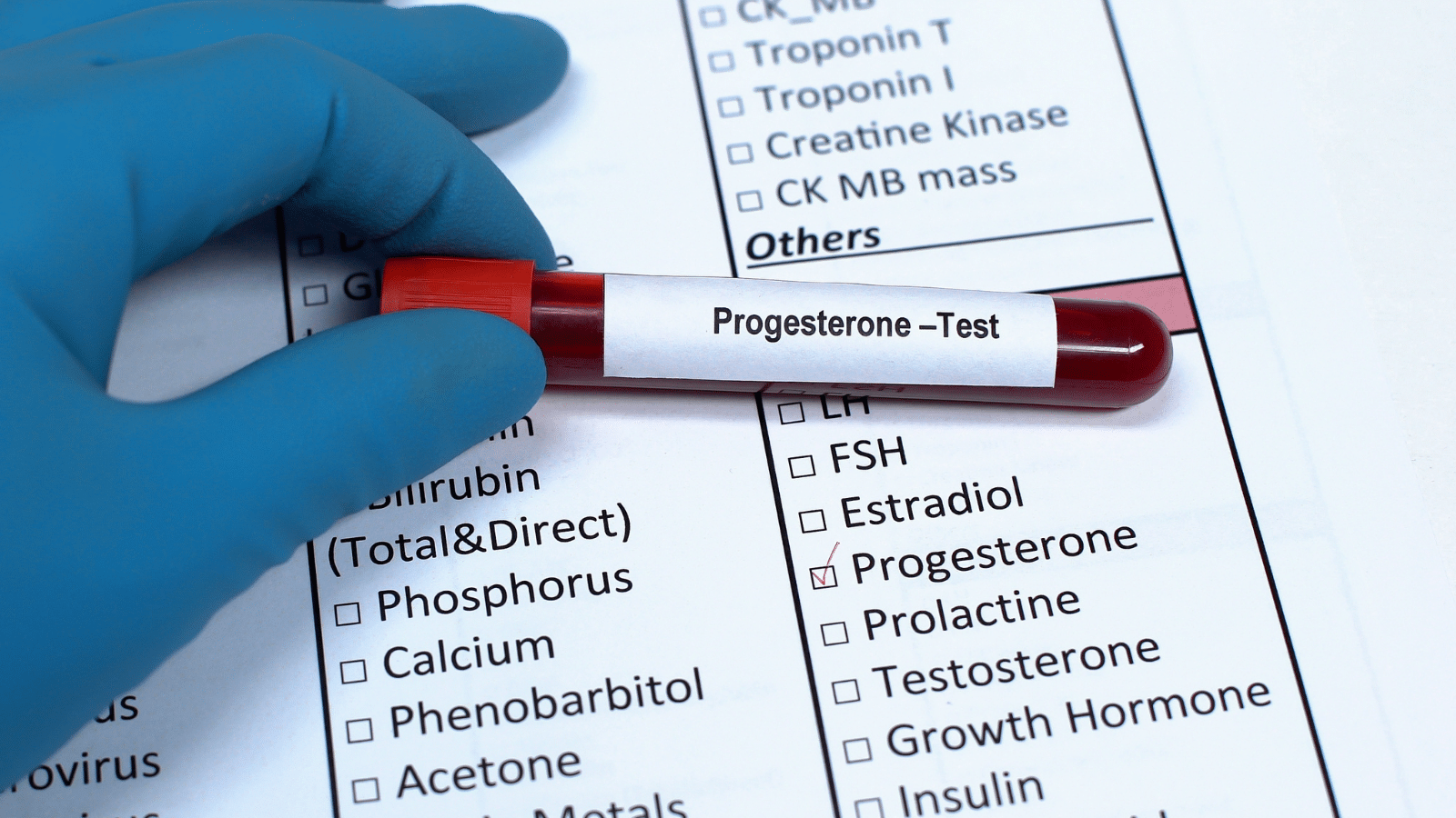 How and Why to Increase Progesterone - Cynthia Williams Wellness